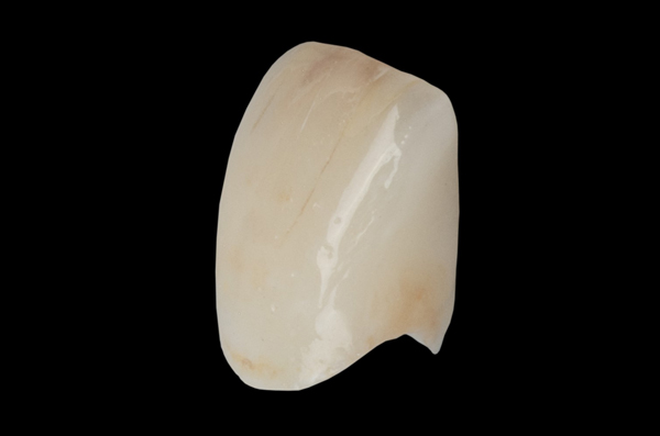 Synergy Ceramics - bespoke dental crowns, bridges & implant restorations